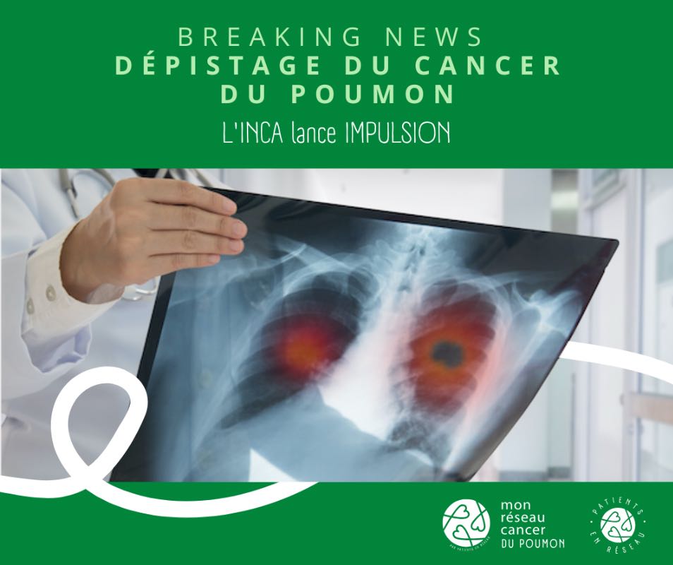 Dépistage du cancer du poumon : l'Institut National du Cancer lance IMPULSION